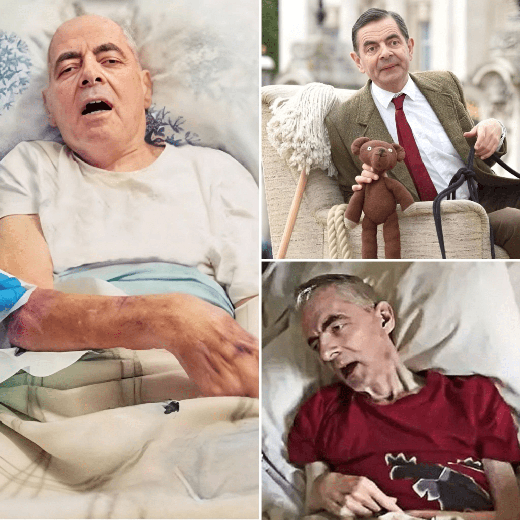 WORLD IN TEARS: Rowan Atkinson â€” The Eternal Mr. Bean â€” Dies at 70 ...